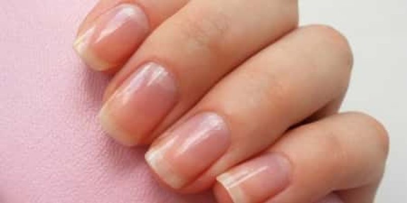 Painful Infected Hangnail on Finger - Health Advisor
