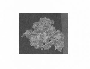 Dead Skin on Scalp - Health Advisor