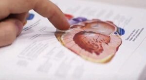 Relapsing Perichondritis: Causes, Signs and Treatment - Health Advisor