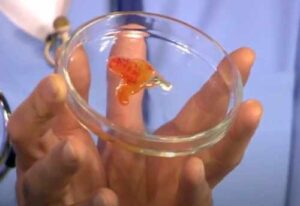 Cough Up Blood With Mucus - Health Advisor